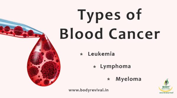 Fight Blood Cancer With Immunotherapy - Body Revival